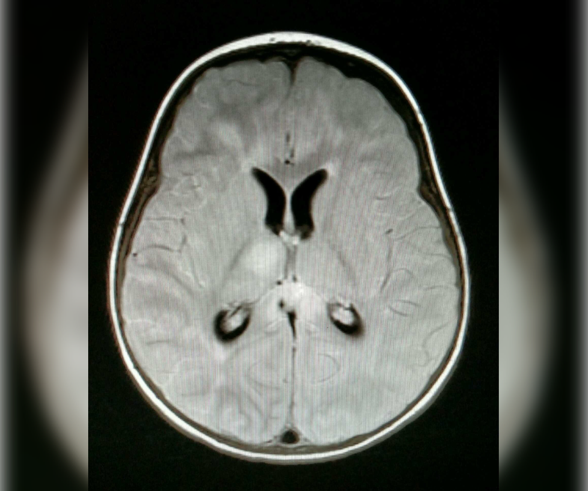 The Most Interesting Medical Cases In Neurology Figure 1 the-most-interesting-medical-cases-in-neurology-figure-1