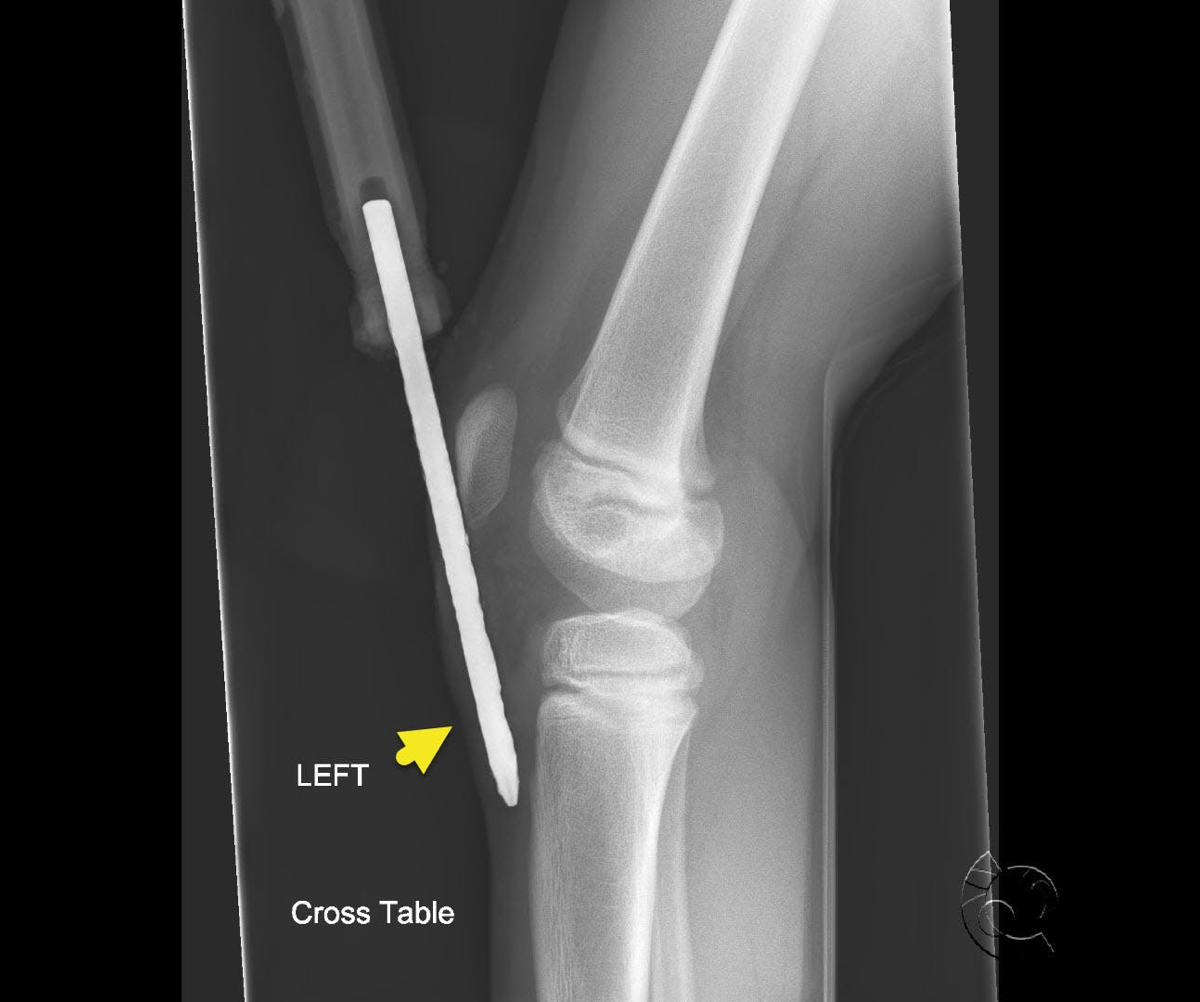 The Most Interesting Medical Cases Of Traumatic Injury Figure 1 the-most-interesting-medical-cases-of-traumatic-injury-figure-1